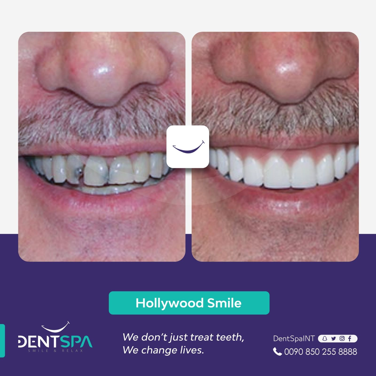 Dentspa Smile And Relax The Most Comfortable Dental Clinic In Turkey